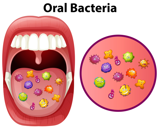 Everything You Need to Know About Oral Infections and How to Treat Them ...