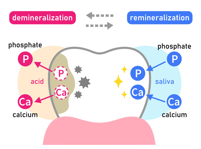 Your Teeth Could Be Being Eaten Away by Acid Erosion without You Know ...