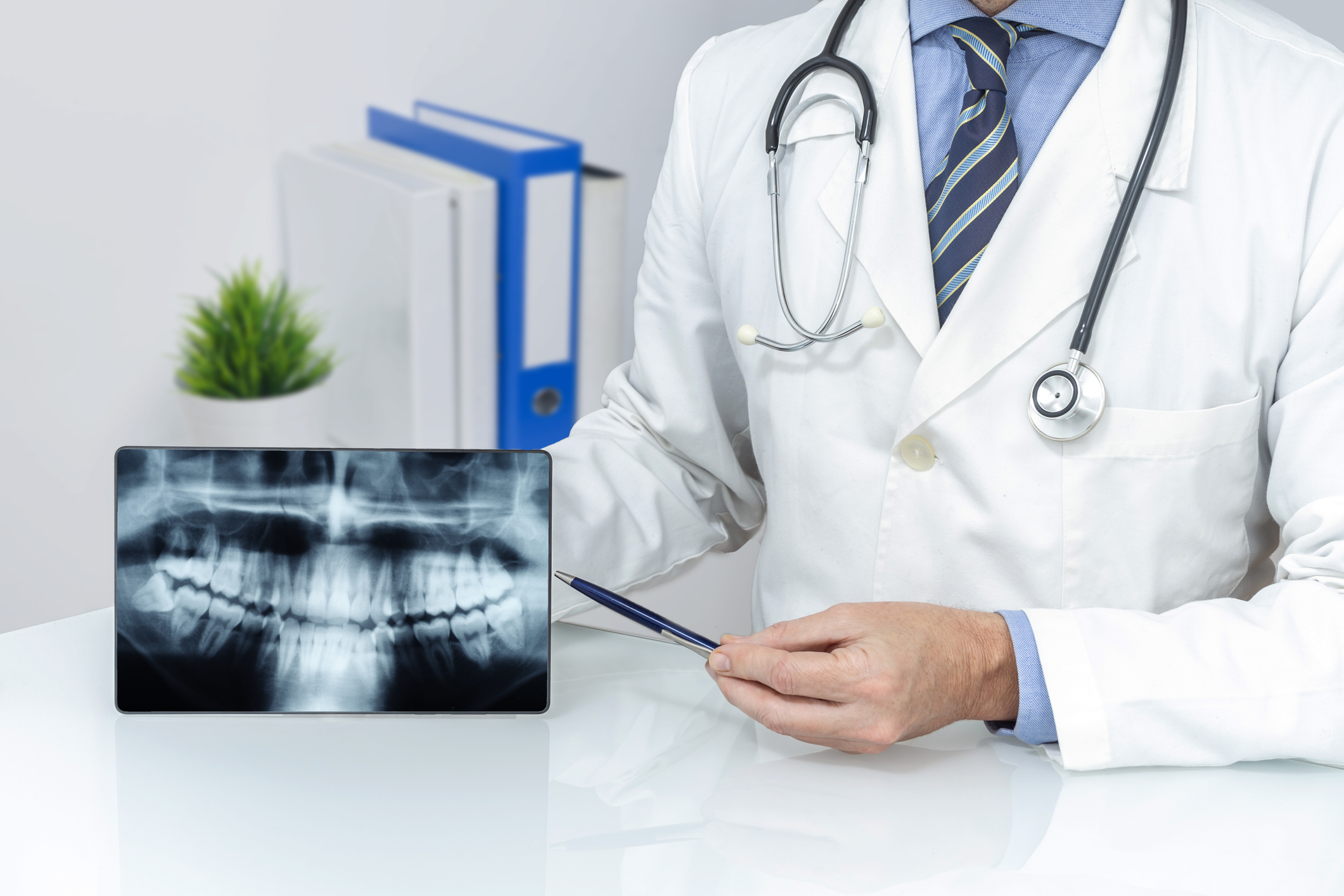 How Safe Are Dental X-Rays? A California Dentist Explains - Call Today ...